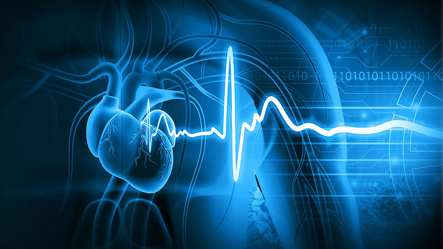 Cardiovascular Advanced Practice - Cizik School of Nursing at UTHealth ...